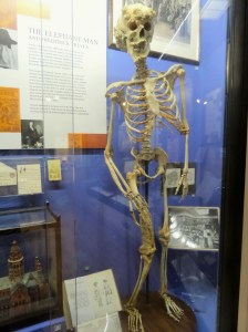 The Controversy of Human Remains in Museums – Last Posts